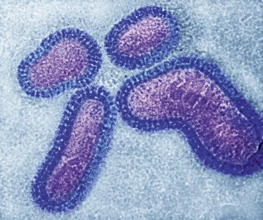 Opgave 26. Immunforsvaret
